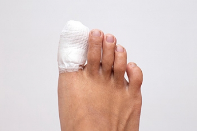What to Do About a Broken Toe